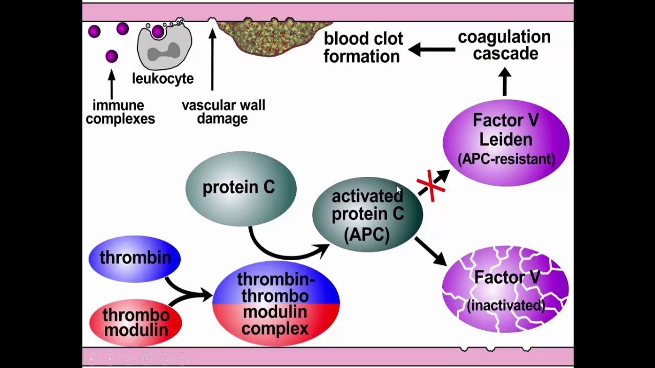 video 20 tromboses causas e CIVD 21 min - YouTube