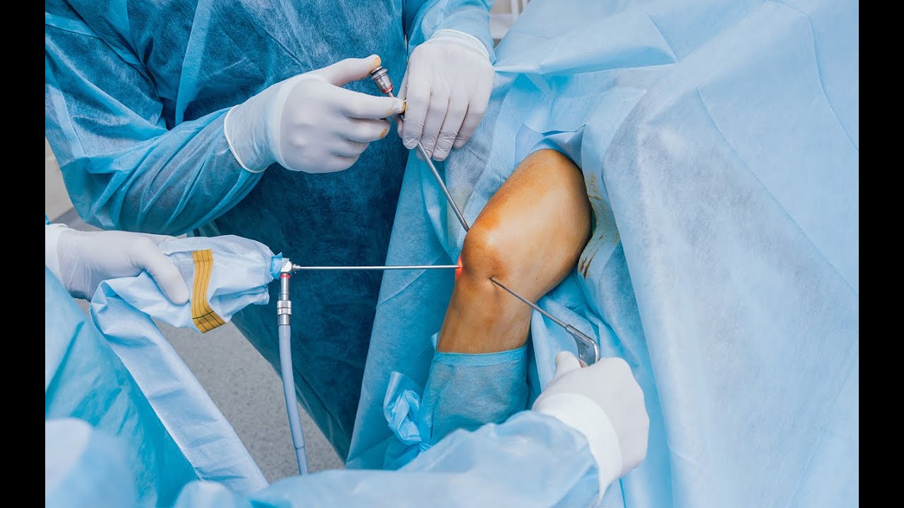 Arthroscopy Knee CPT Code Simplify Medical Coding YouTube
