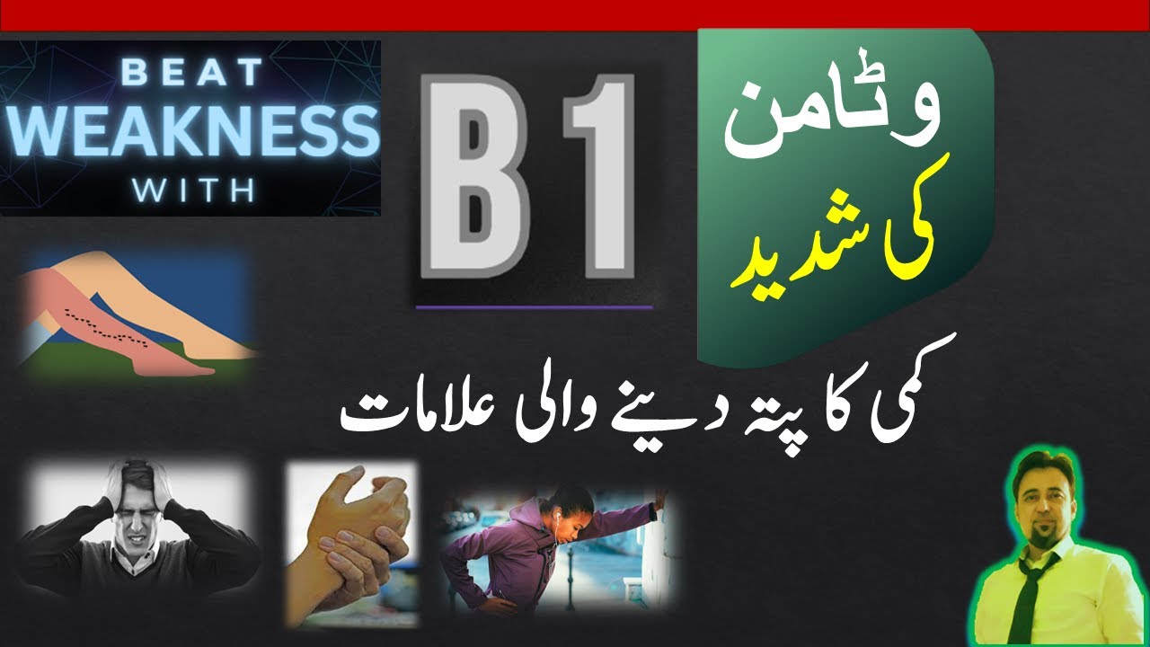 Vitamin B1 Deficiency Signs | Beat Your Weakness - YouTube