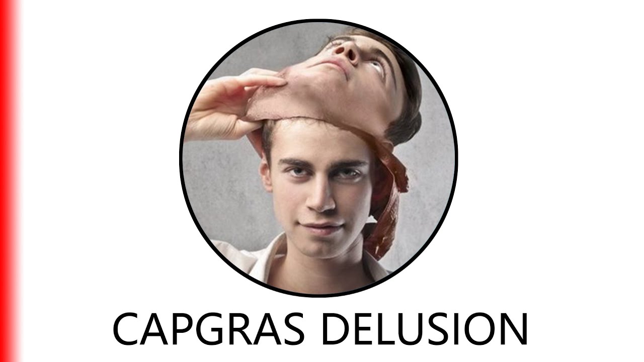 CAPGRAS DELUSION. - YouTube