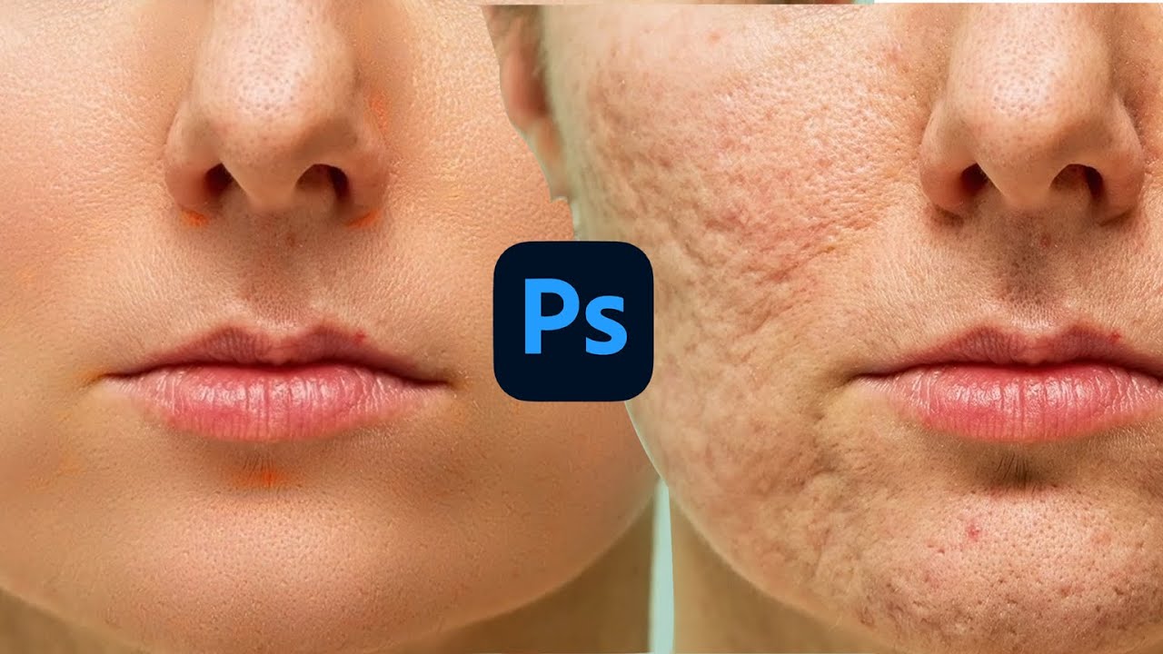 31.How to Quickly Smooth Skin and Remove Dark Spots, Blemishes & Scars ...