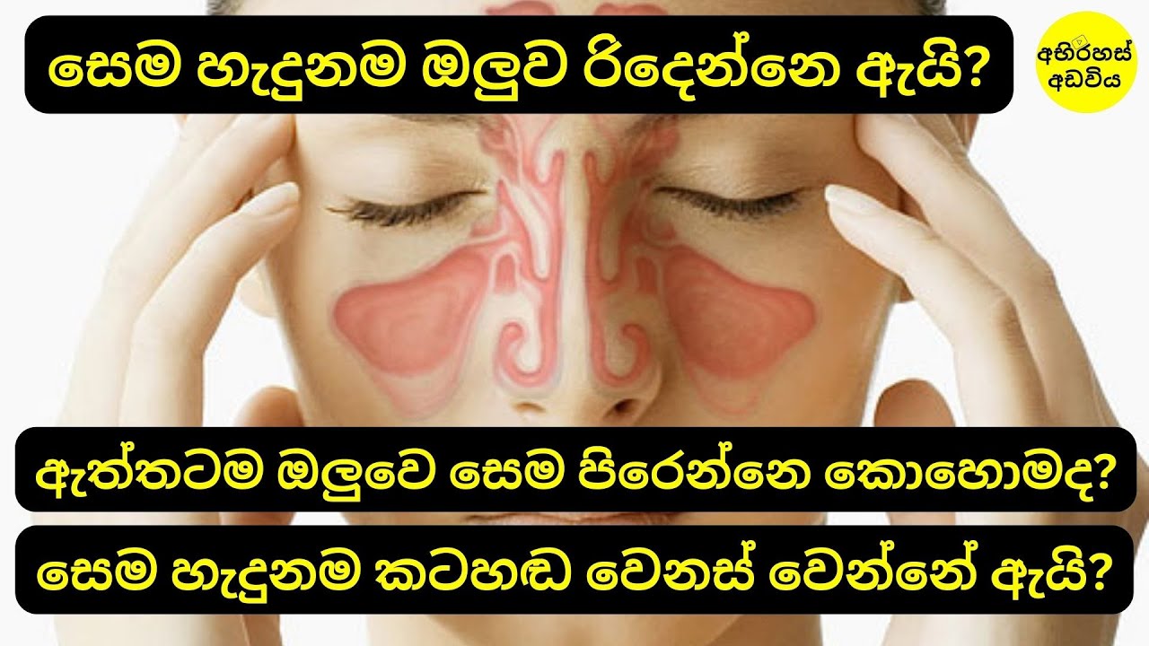 Why does the head hurt when phlegm? | සෙම හැදුනම ඔලුව රිදෙන්නෙ ඇයි ...