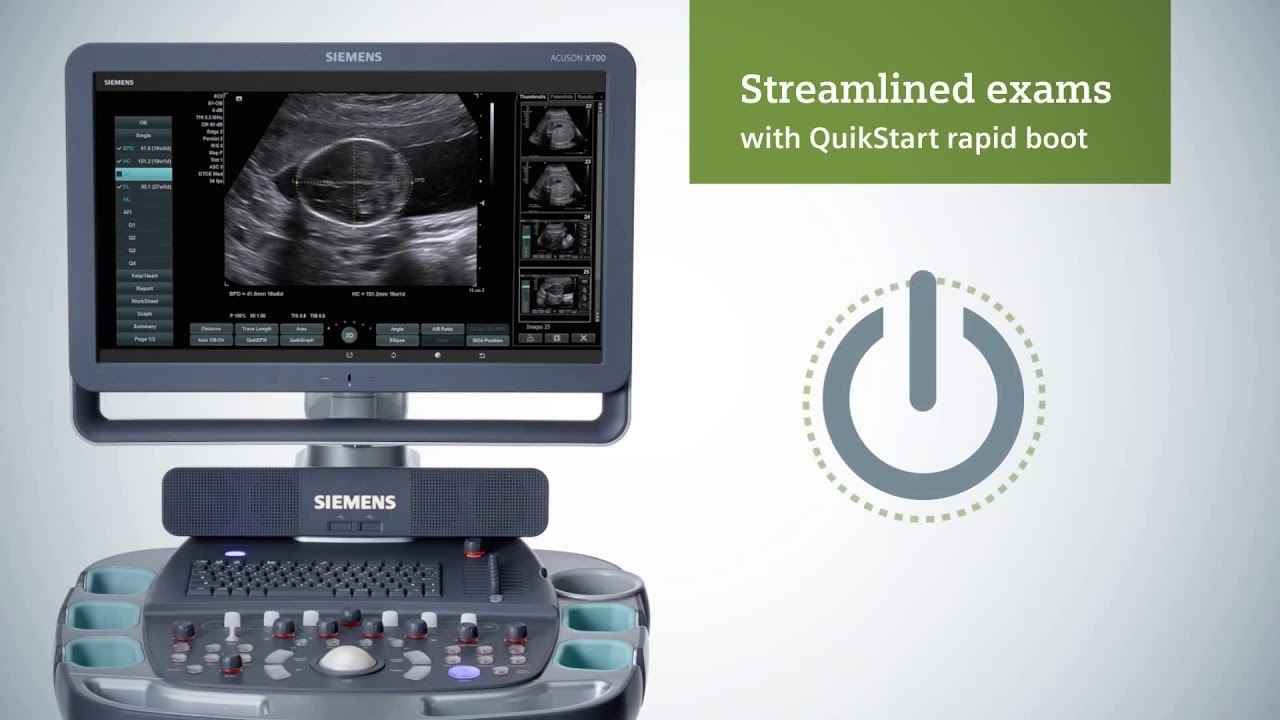 SIEMENS ACUSON X700 - YouTube