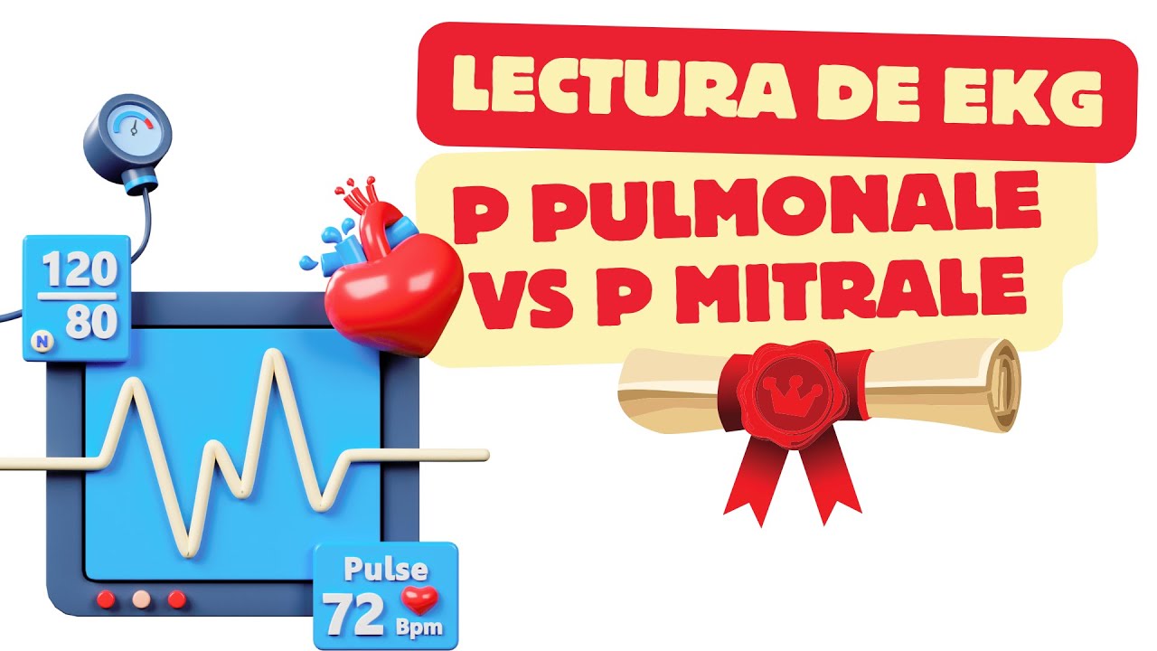 "Decodificando el EKG ️💯: Diferenciando P Pulmonale de P Mitrale en ...