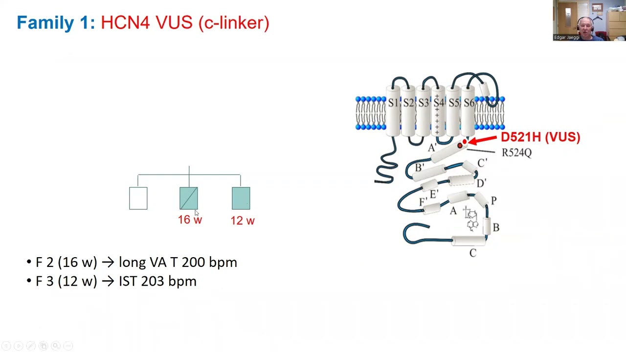 Fetal Manifestations of HCN4 Mutation - YouTube