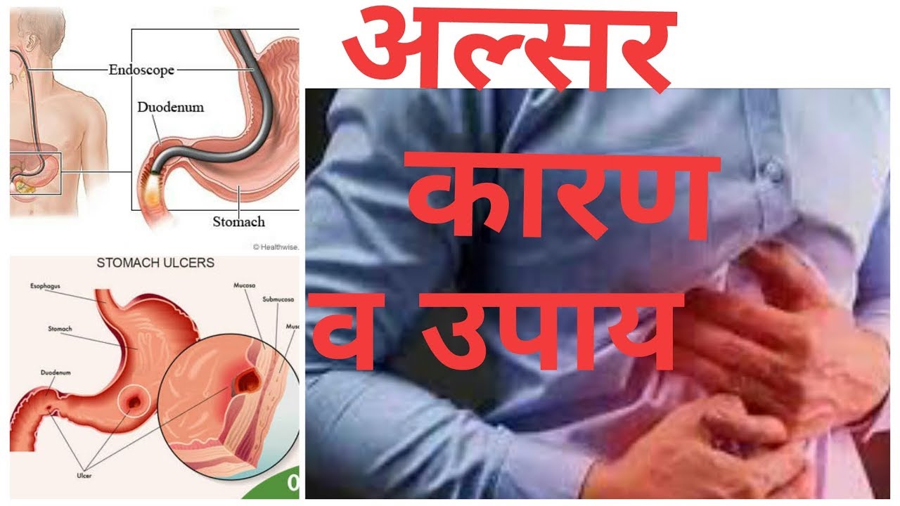 Alsar! Karan va upay - YouTube