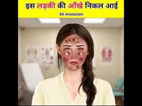 नकली आँखे निकल आई 👁 3D Animaion Video #3danimation #asmr #satisfying #trending #shorts - YouTube