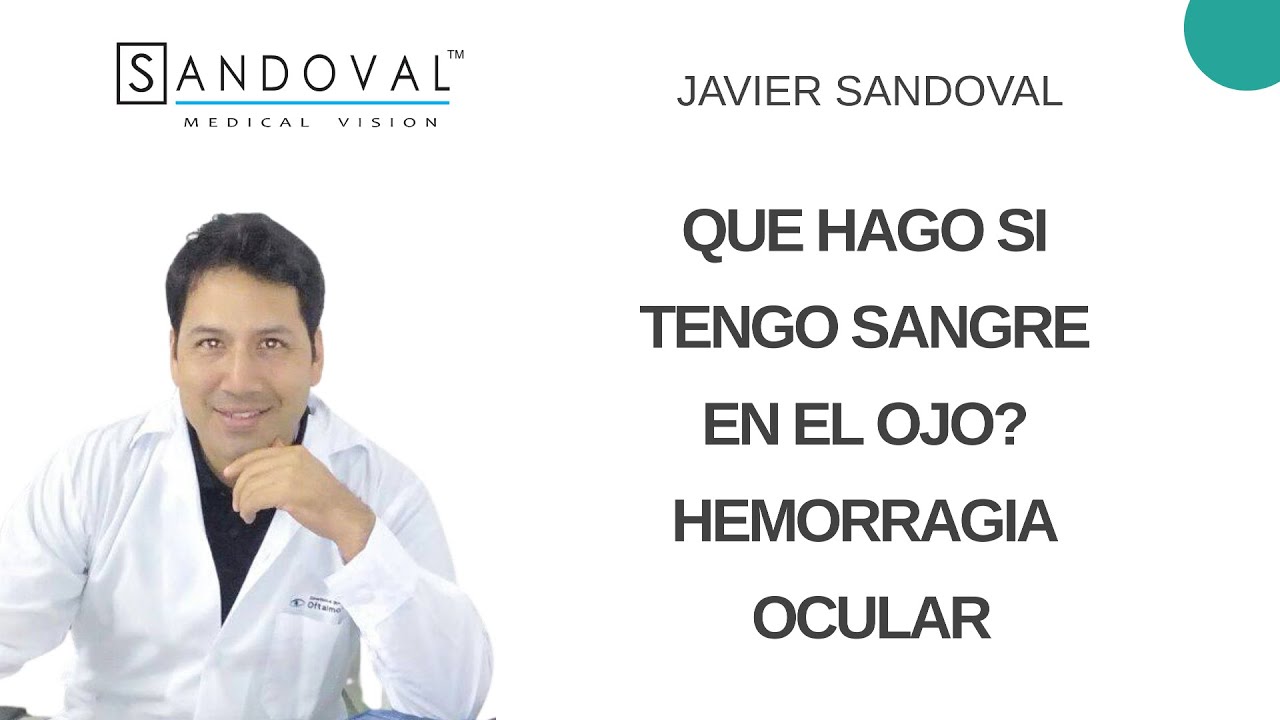 ¿Qué hago si tengo sangre en el ojo? hemorragia ocular - sandoval ...