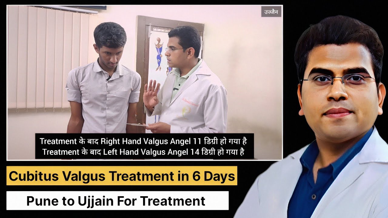 Cubitus Valgus Treatment in 6 Days | cubitus valgus - YouTube