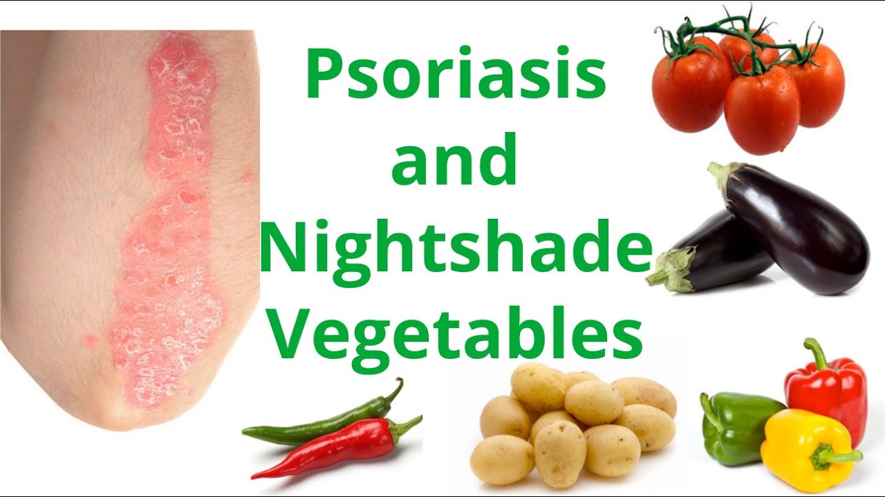 Psoriasis And Nightshade Vegetables To Eat Or Not To Eat YouTube Psoriasis And Nightshade Vegetables To Eat Or Not To Eat YouTube