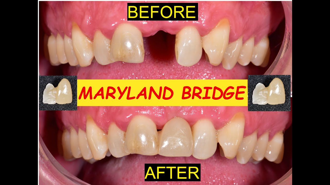 [43] Maryland Bridge Walkthrough - YouTube