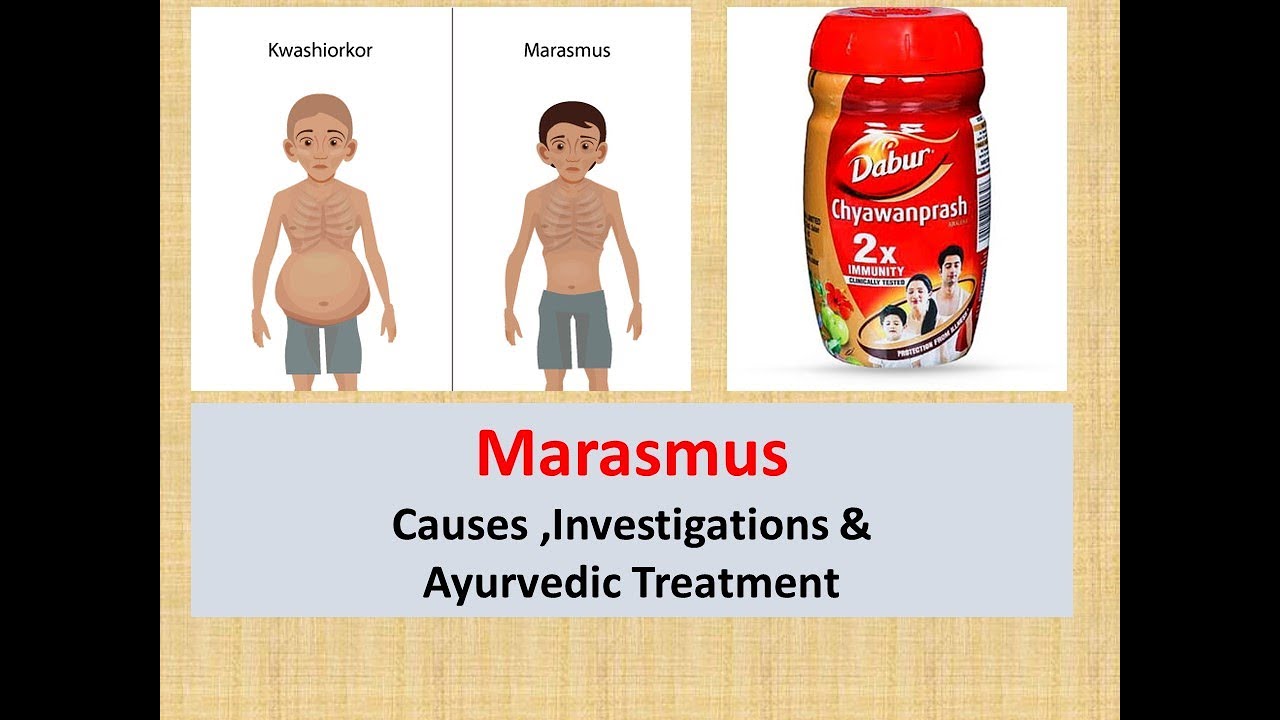 I Tried AYURVEDIC Treatment For Marasmus And Here's What Happened - YouTube
