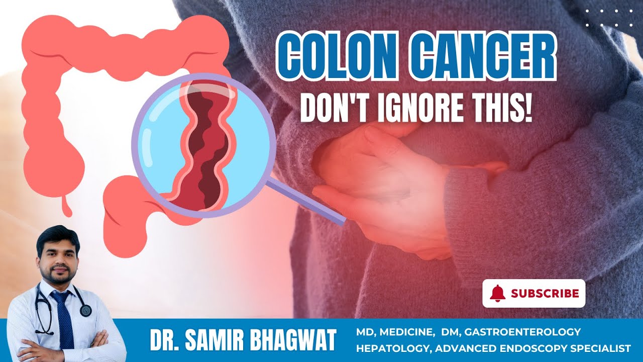 Colon Cancer: Causes, Symptoms & Prevention Tips You Must Know - YouTube