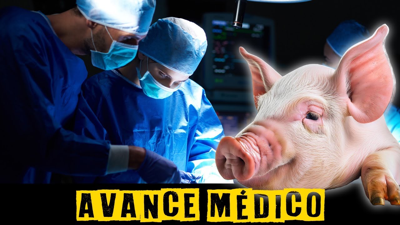 CHINA LOGRA el PRIMER TRANSPLANTE de HIGADO de CERDO a un HUMANO - YouTube