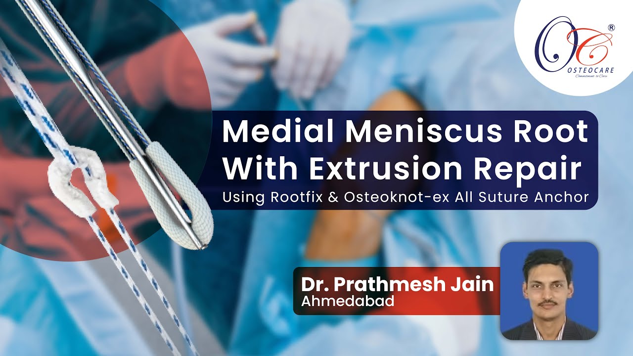 Medial Meniscus Root Tear and Extrusion Repair using All Suture Anchor ...