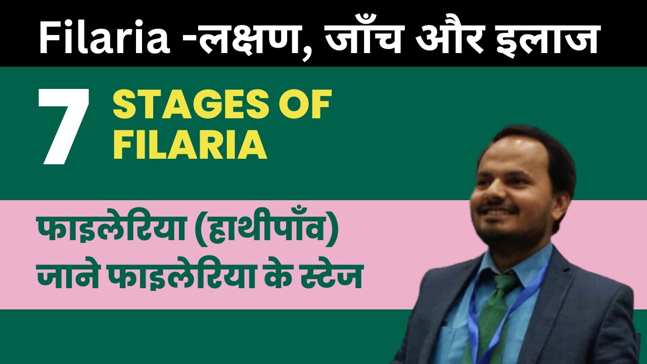 Filaria ka ilaj || Stages of Filaria || Filaria ke lakshan || Filaria ...