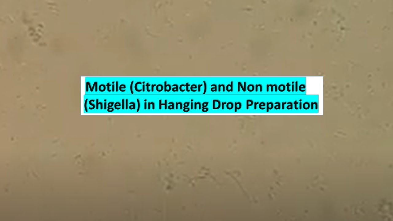 Motile (Citrobacter) and Non motile ( Shigella) in Hanging Drop ...