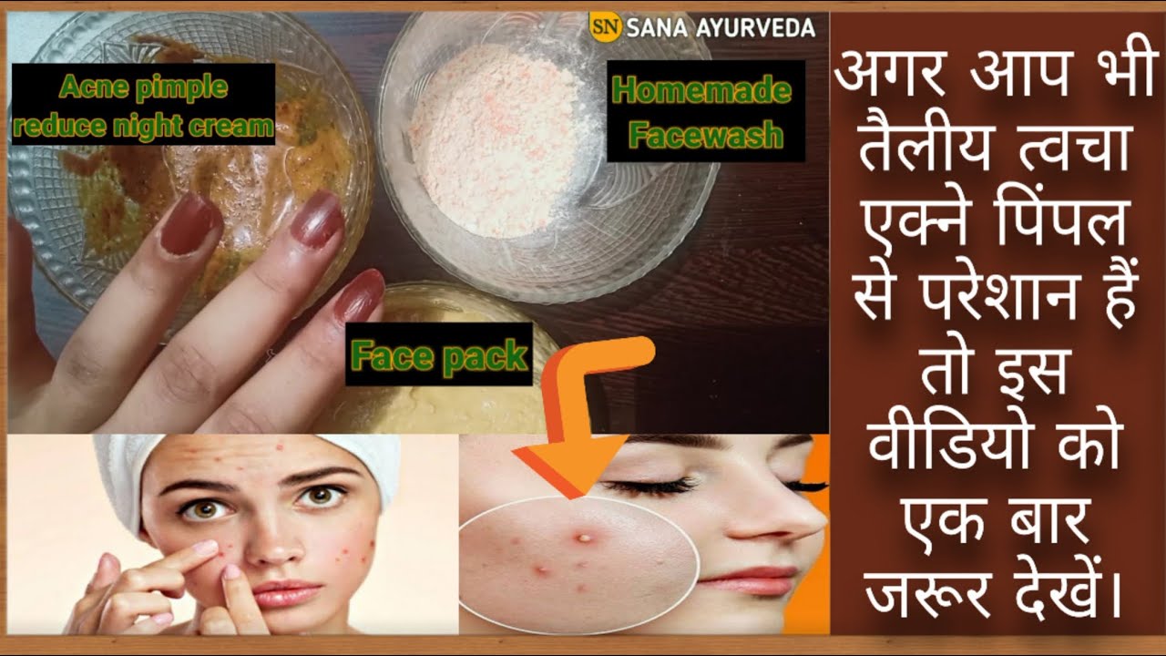 Oily skin(तैलीय त्वचा) or acne pimple se nijat Pana chahte Hain To is ...