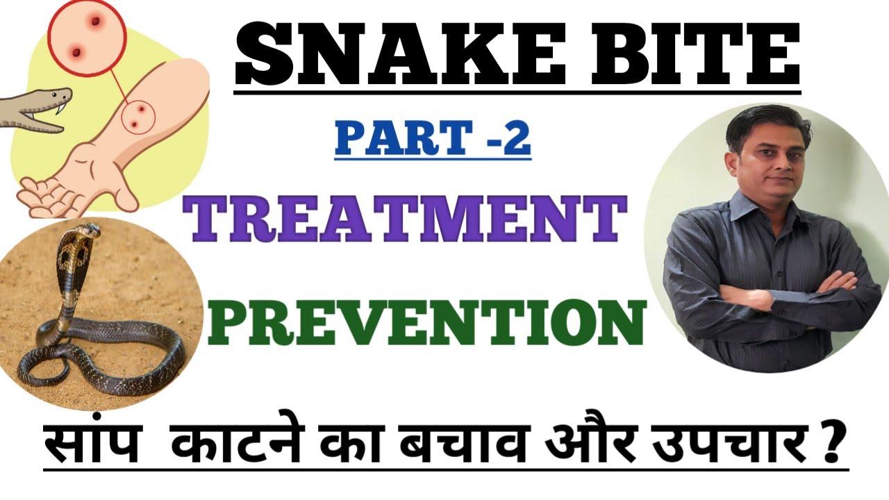 SNAKE BITE - DR.SHIVALKAR,TREATMENT,PREVENTION,MANAGEMENT,SIGN&SYMPTOMS ...