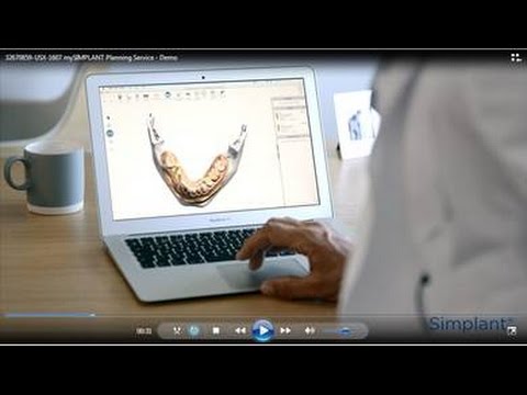 Simplant Planning Service - YouTube