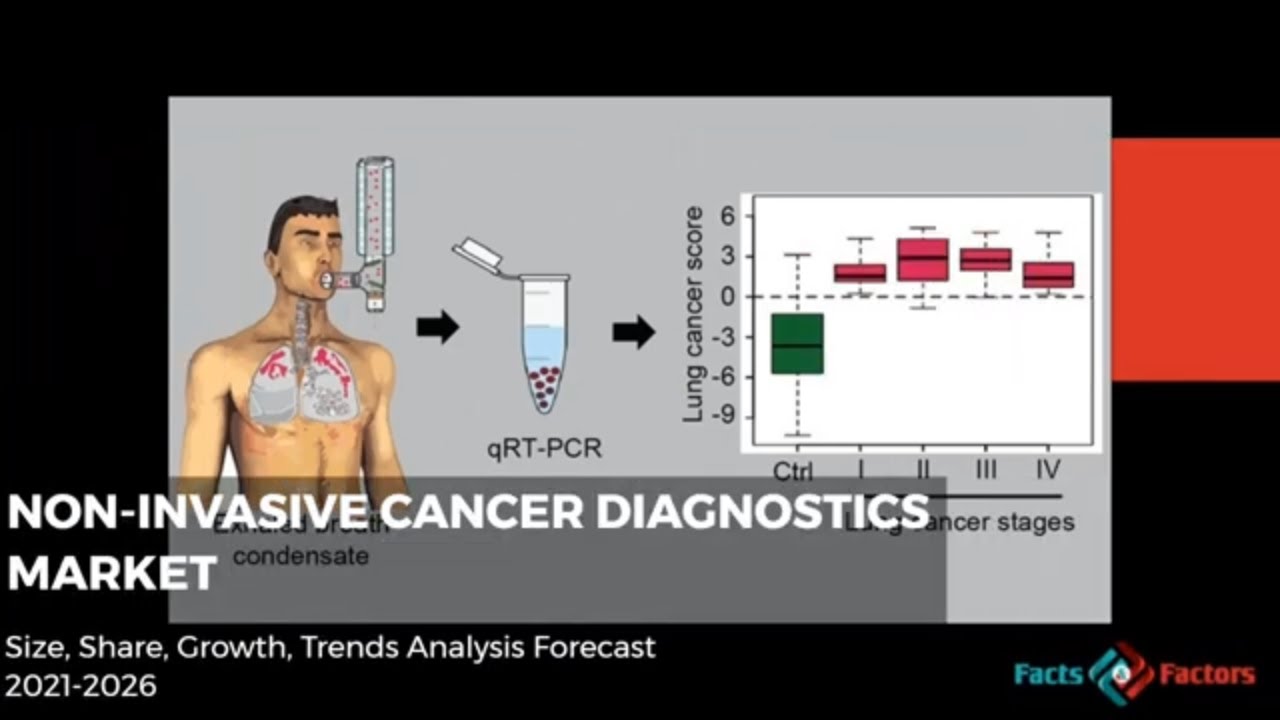 Global Non-Invasive Cancer Diagnostics Market Size (2023-2030) Share ...