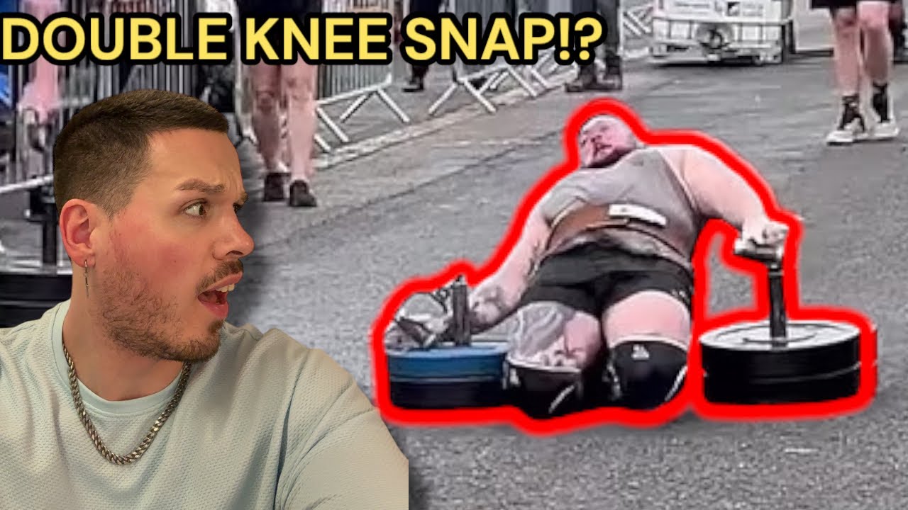 Strongman Powerlifter Snaps Both Tendons and Knees in Competition - YouTube