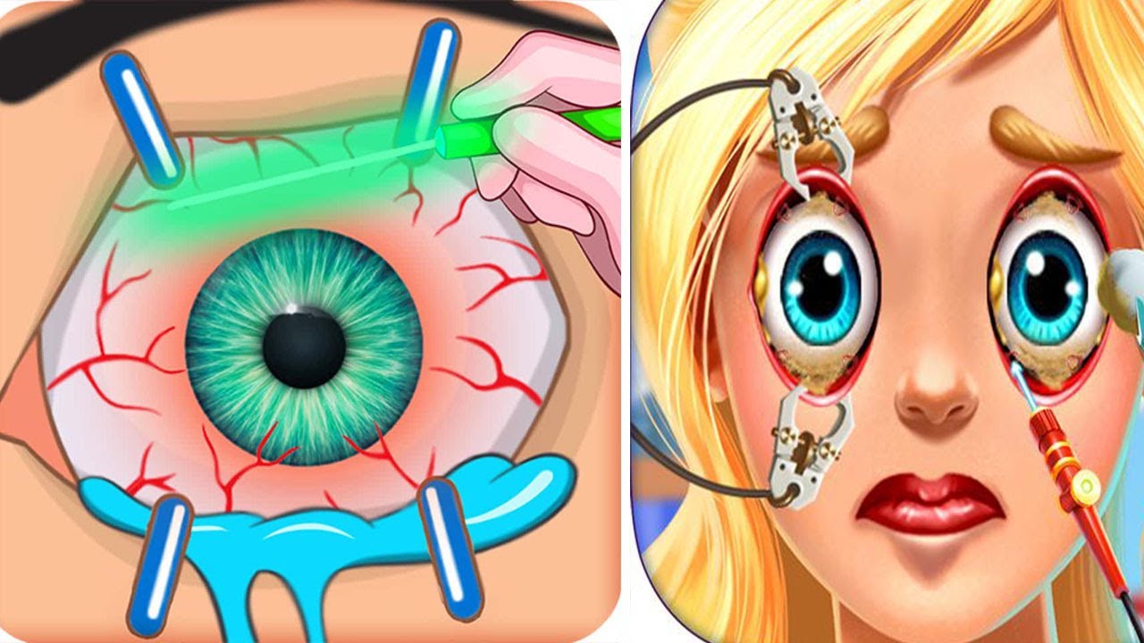 ASMR Eye Stone Removal Animation | Treatment of conjunctivitis NO BGM ...
