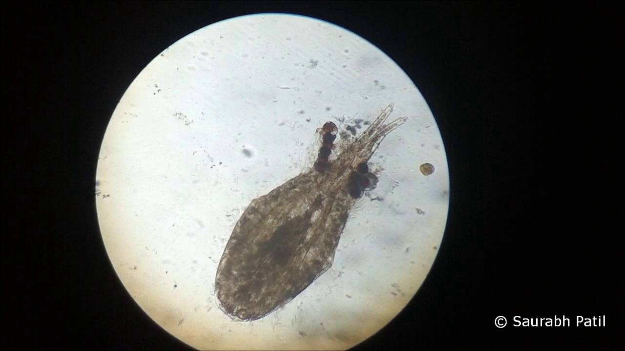 Cyclops under dissecting microscope - YouTube