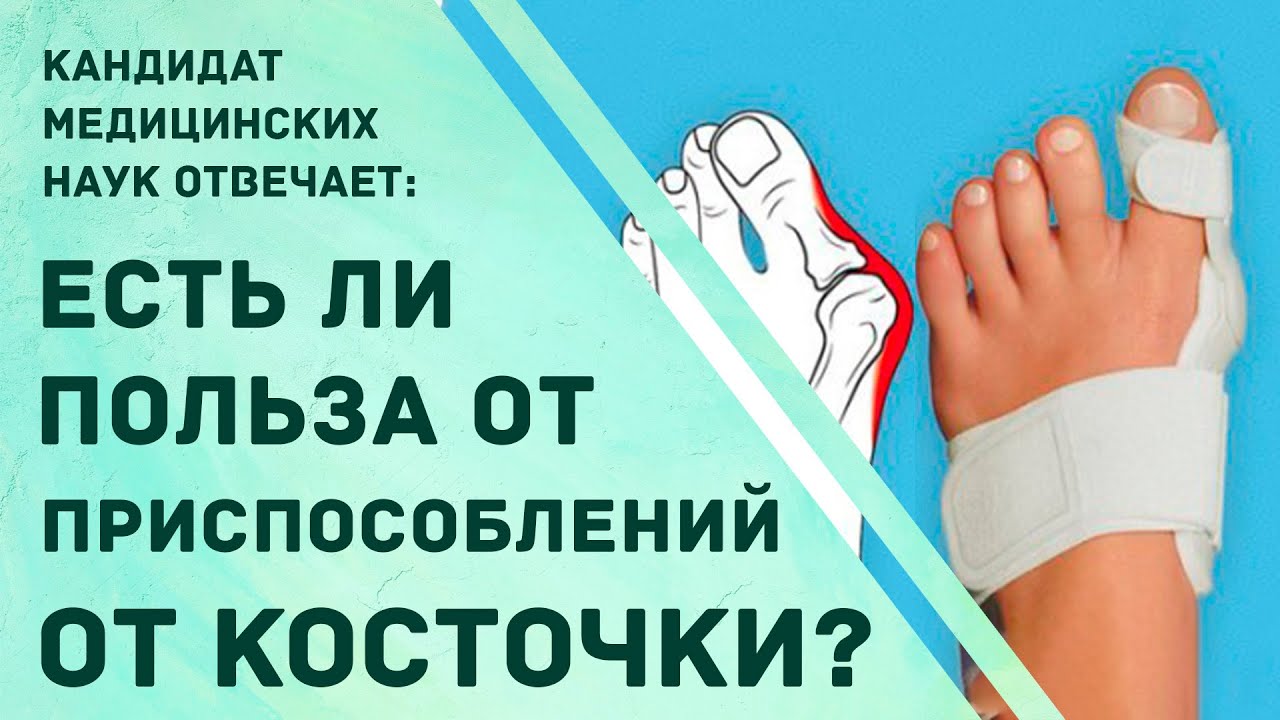 Эффективность приспособлений от косточки на стопе Бандаж фиксатор