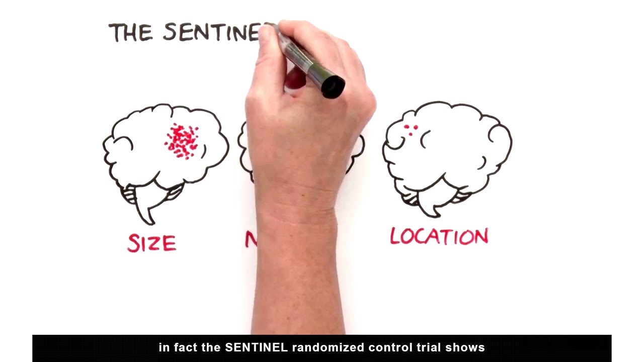 Physician Whiteboard Animation: Cerebral Embolic Debris Cascade and ...