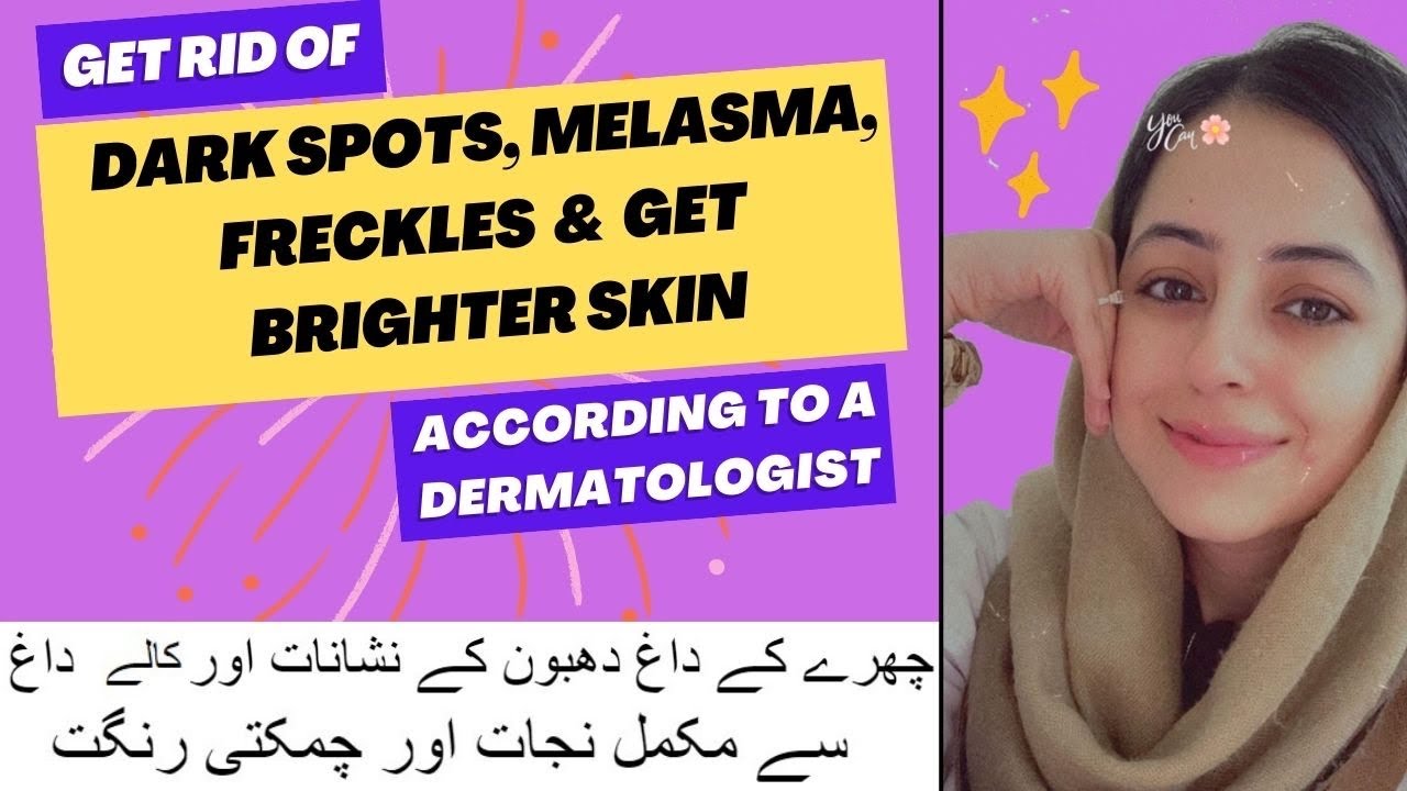 Get rid of Melasma/Dark Spots instantly! - YouTube