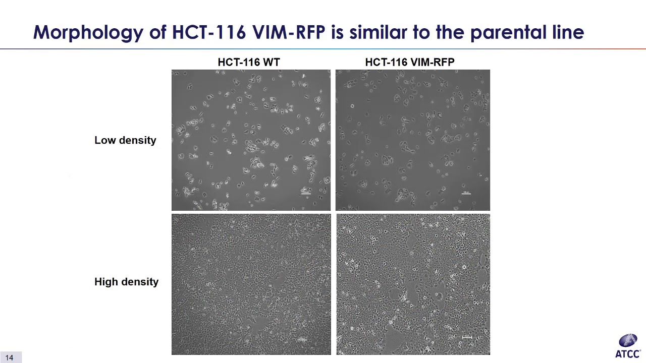 Novel EMT Reporter Cell Lines created by CRISPR Technology Webinar ...
