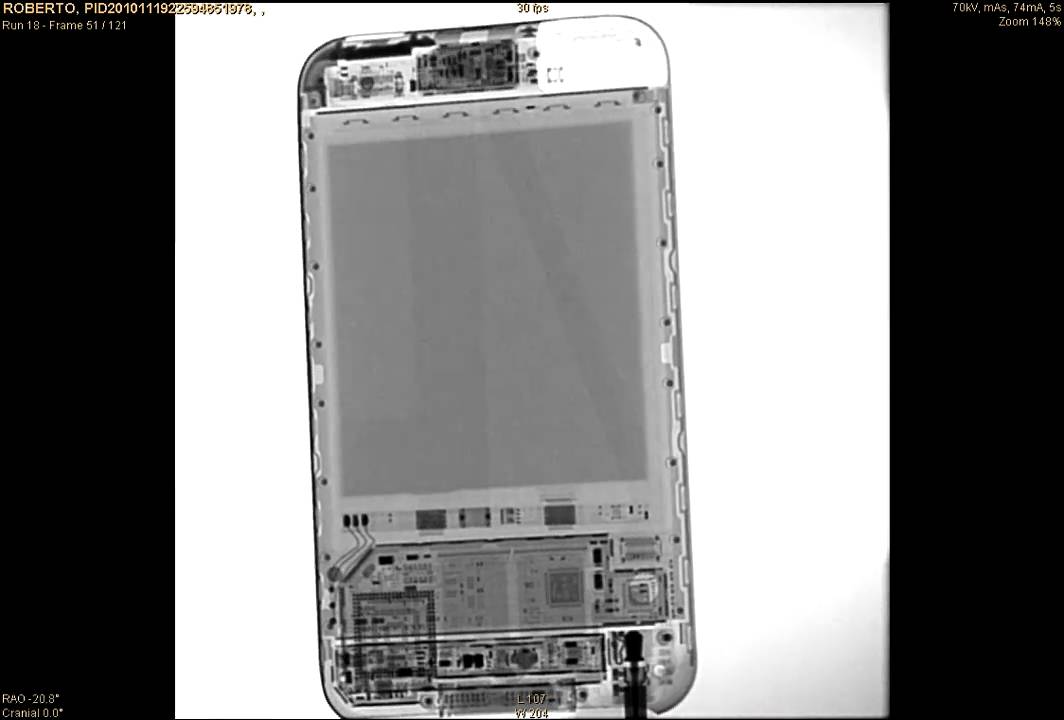 Ipod XR (X ray) - YouTube