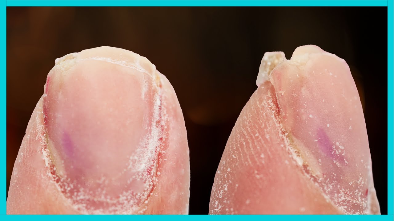 Fix Broken / Glued / Ugly Nail - YouTube