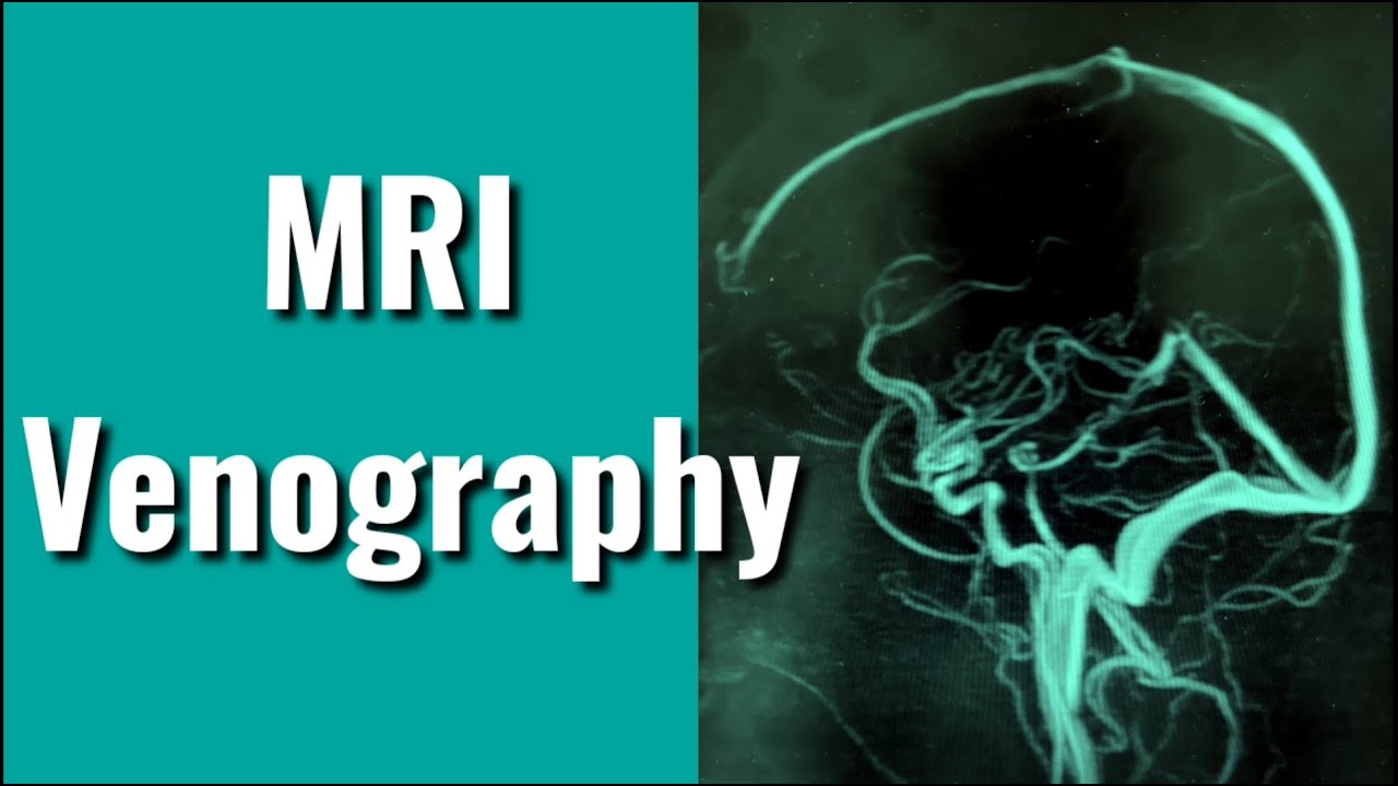 MRI Venography ( Phase - Contrast / 3D ) - YouTube