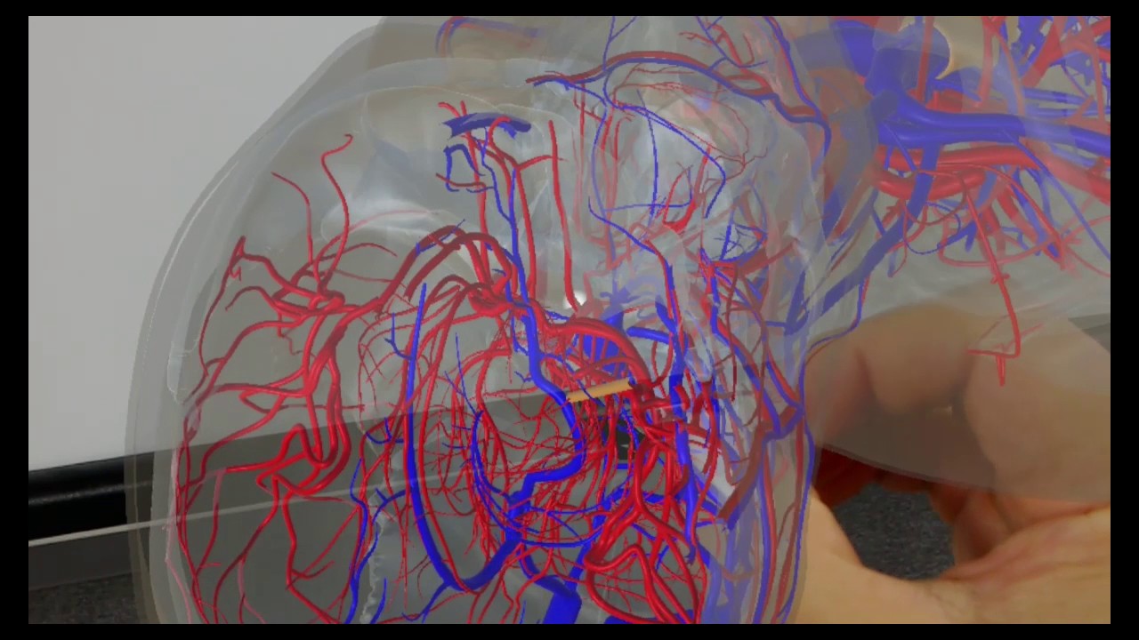 The Holographic Human for surgical navigation using Microsoft Hololens ...