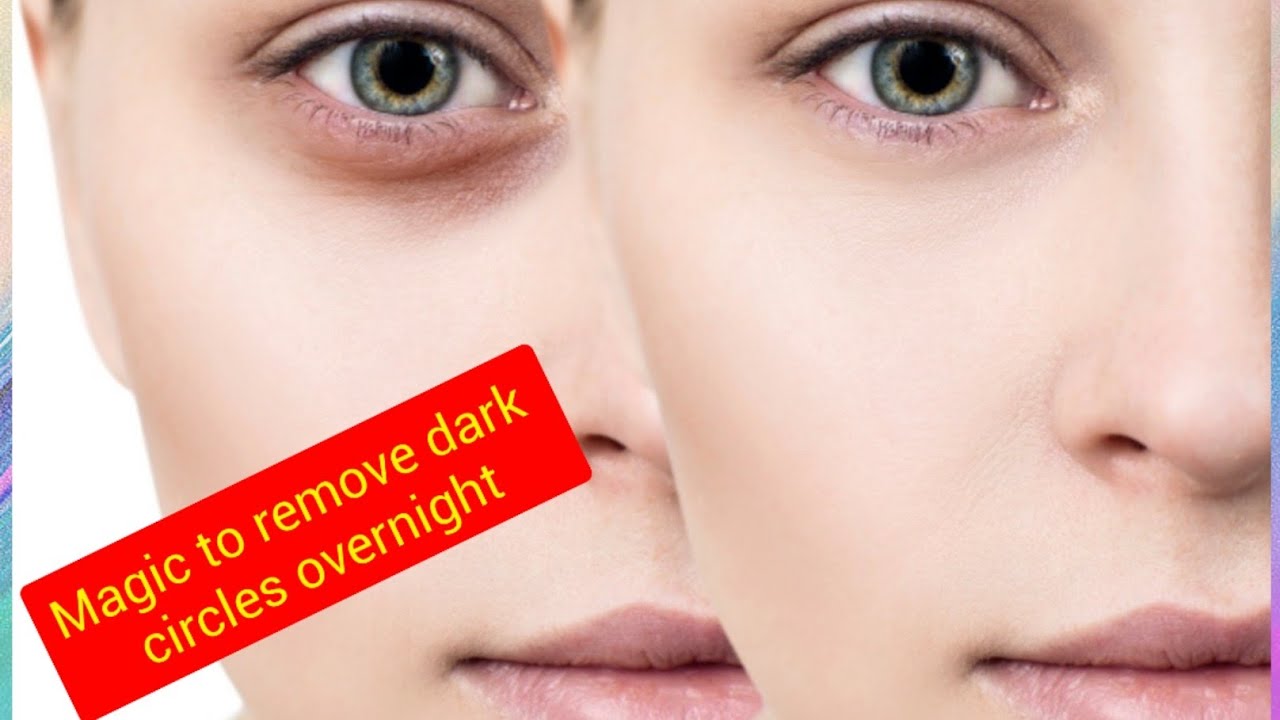 A magic mask to remove dark circles in one use|Magic face mask| - YouTube