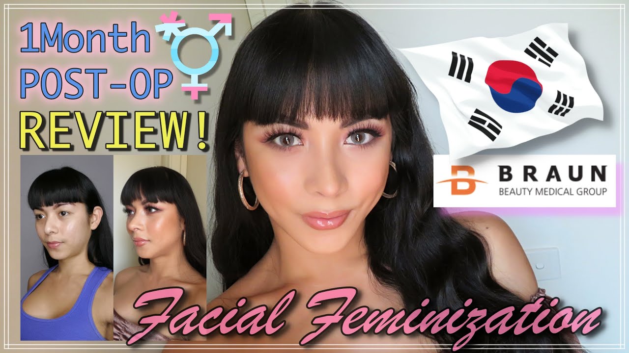 1 Month Post Op Transgender Facial Feminization W Braun Beauty Group Korea Youtube