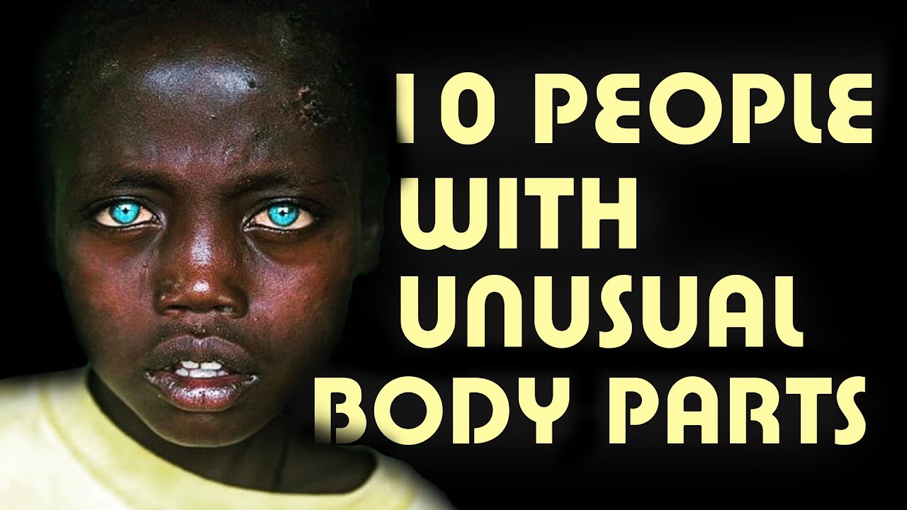 10 People With Unusual Body Parts - YouTube