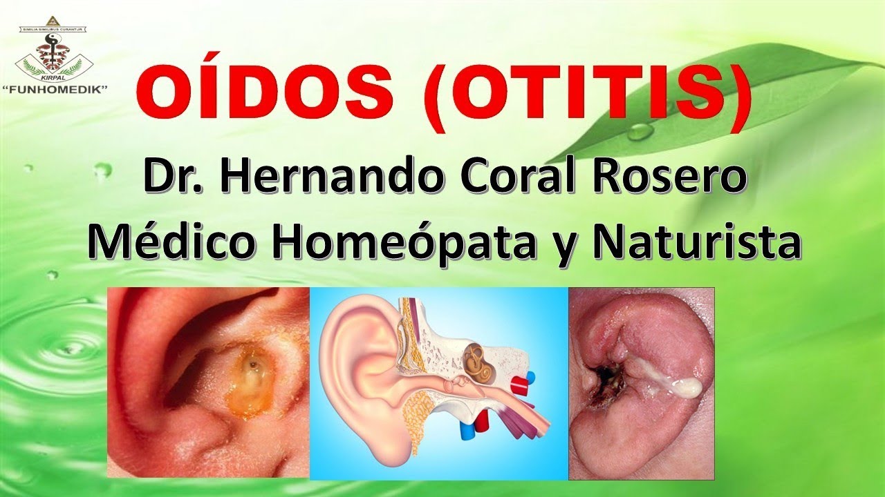 OÍDOS OTITIS - INFLAMACIÓN CON DOLOR, FIEBRE Y TRASTORNOS DE LA ...
