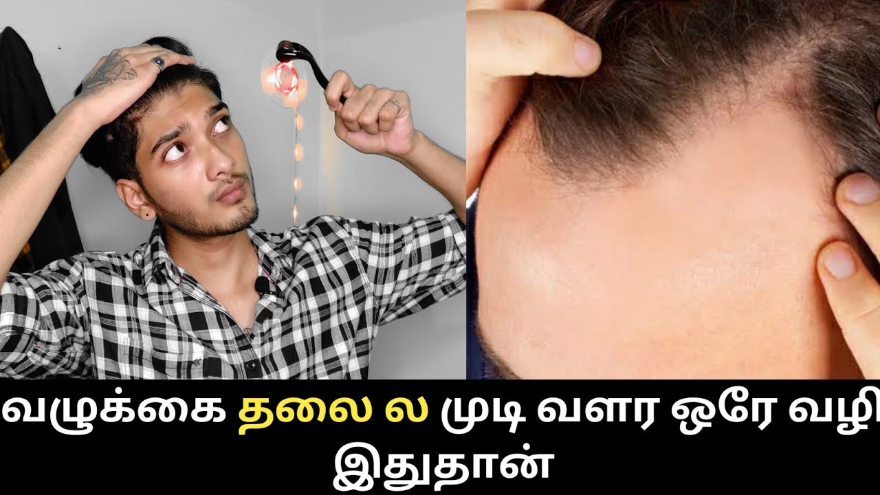 How to grow hair in a bald head | 200% confirm results | AR STUFFZ ...