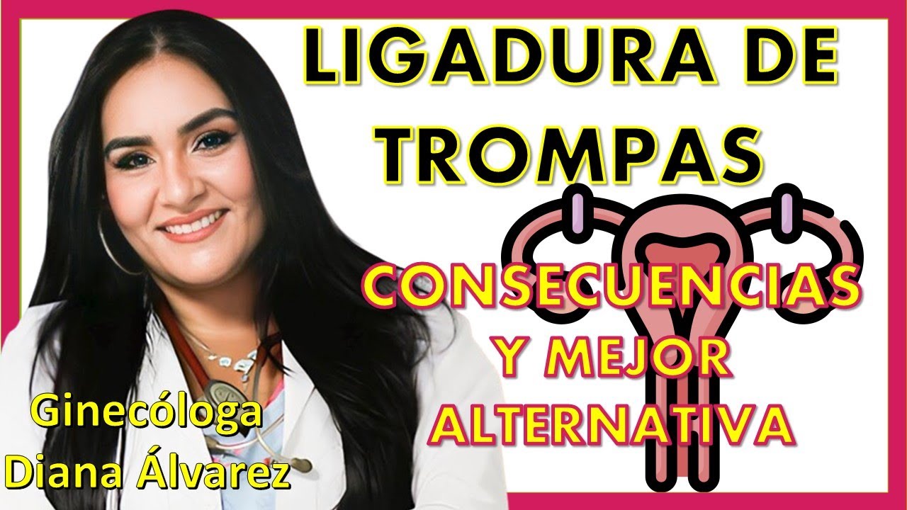 LIGADURA DE TROMPAS, CONSECUENCIAS Y RECOMENDACIONES. | Ginecologa ...