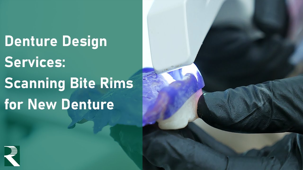 Denture Design Services for In-Office Fabrication: Scanning Bite Rims ...