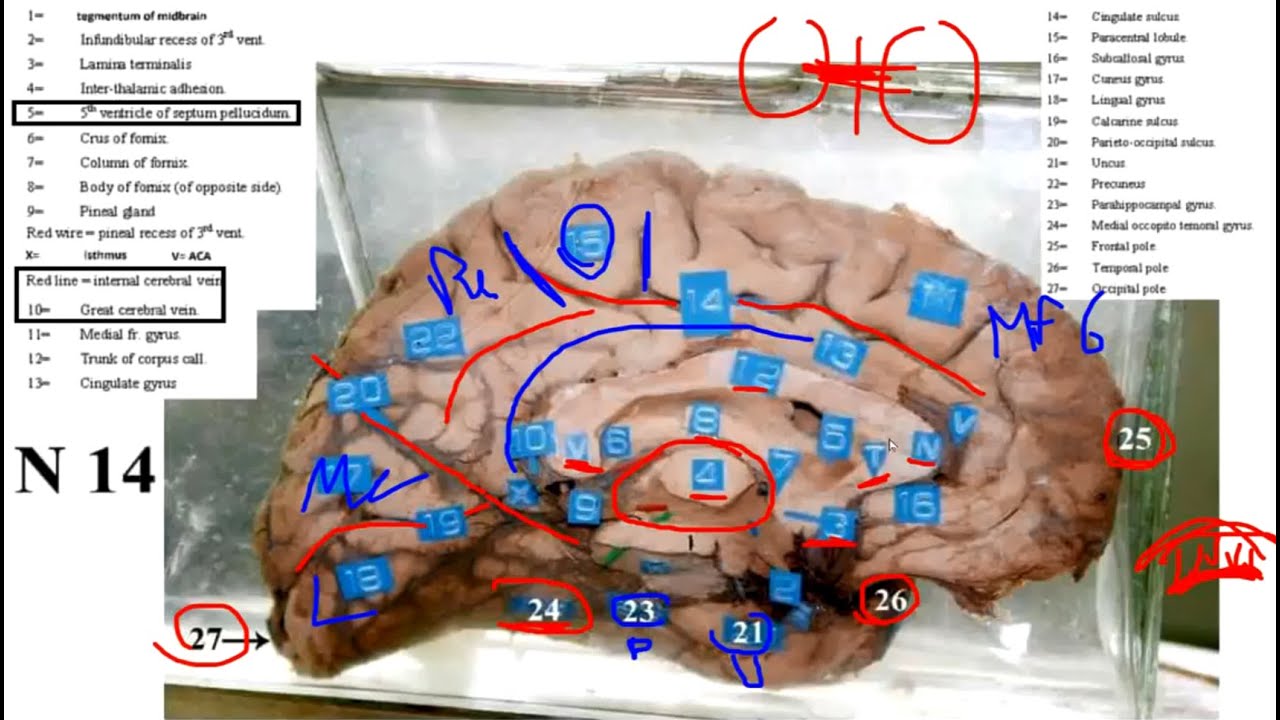 Osce Neuro-Anatomy (part 2) - YouTube