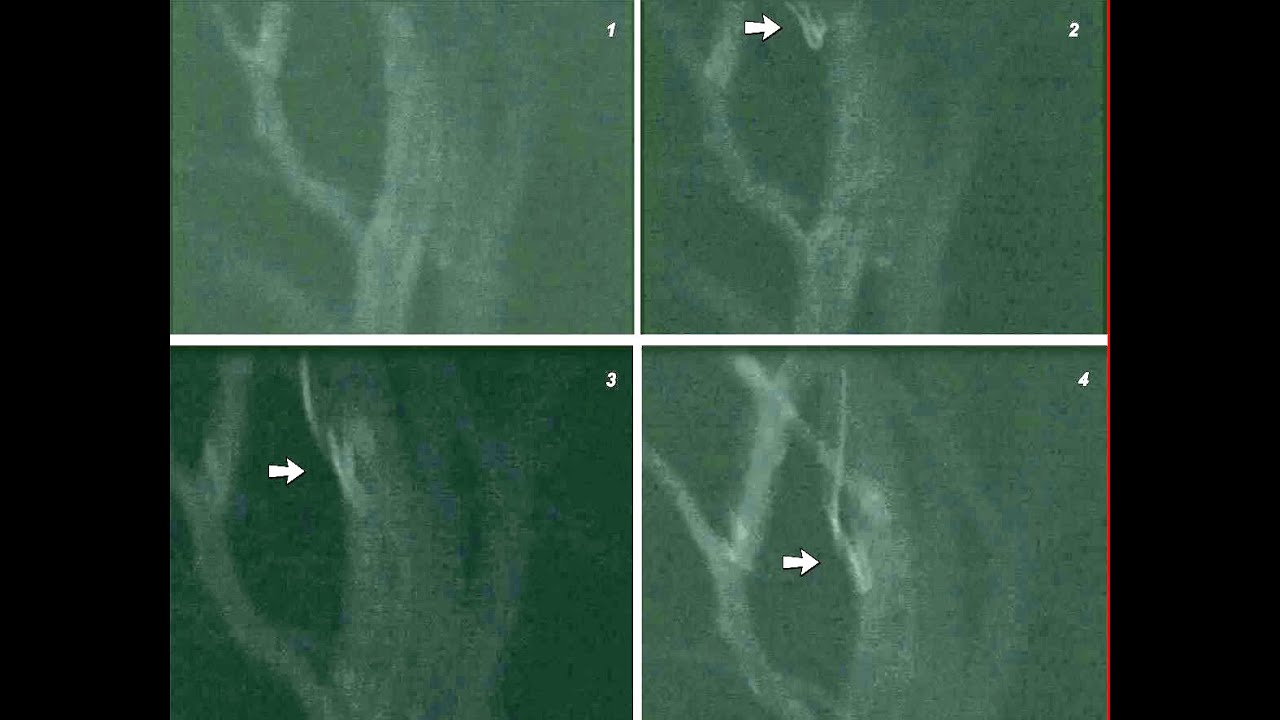 "Ashwar" Creature from the Litchfield (Connecticut) Triangle as ...