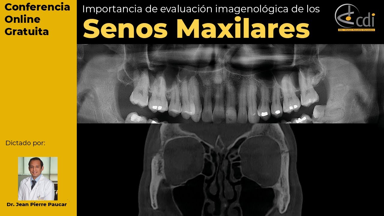Curso: Importancia de evaluación imagenológica de los senos maxilares - YouTube