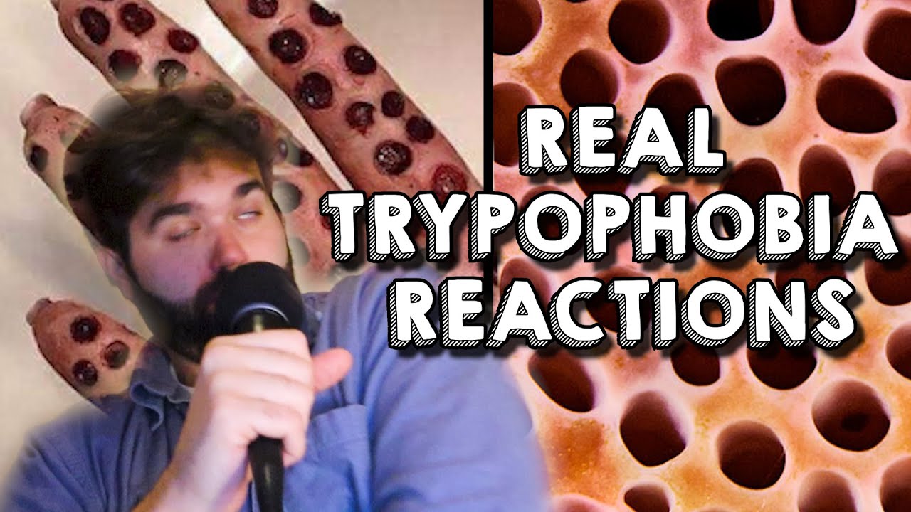 Triggering my Trypophobia Reactions. Fear of Holes in Things! - YouTube
