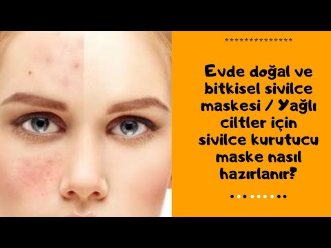 Evde doğal ve bitkisel sivilce maskesi / Yağlı ciltler için sivilce kurutucu maske nasıl hazırlanır?