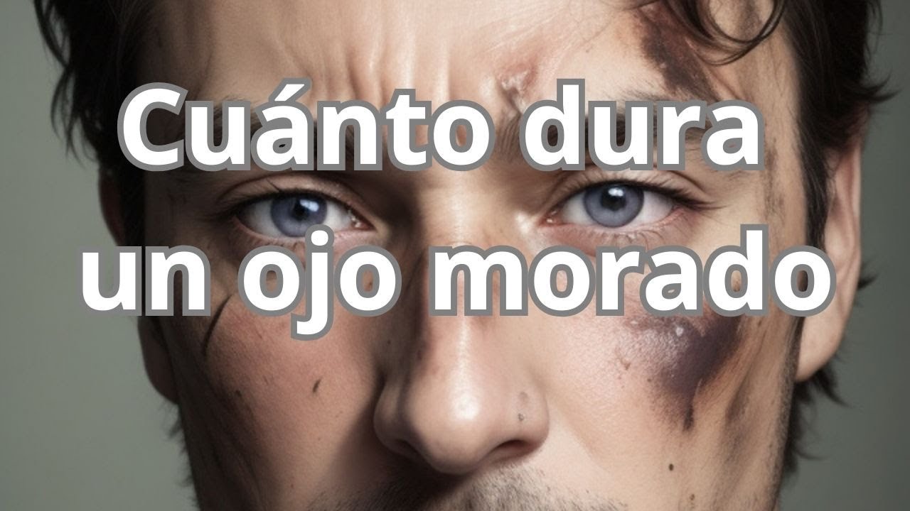 Cuánto Dura un Ojo Morado: Tiempo de Recuperación y Consejos - YouTube