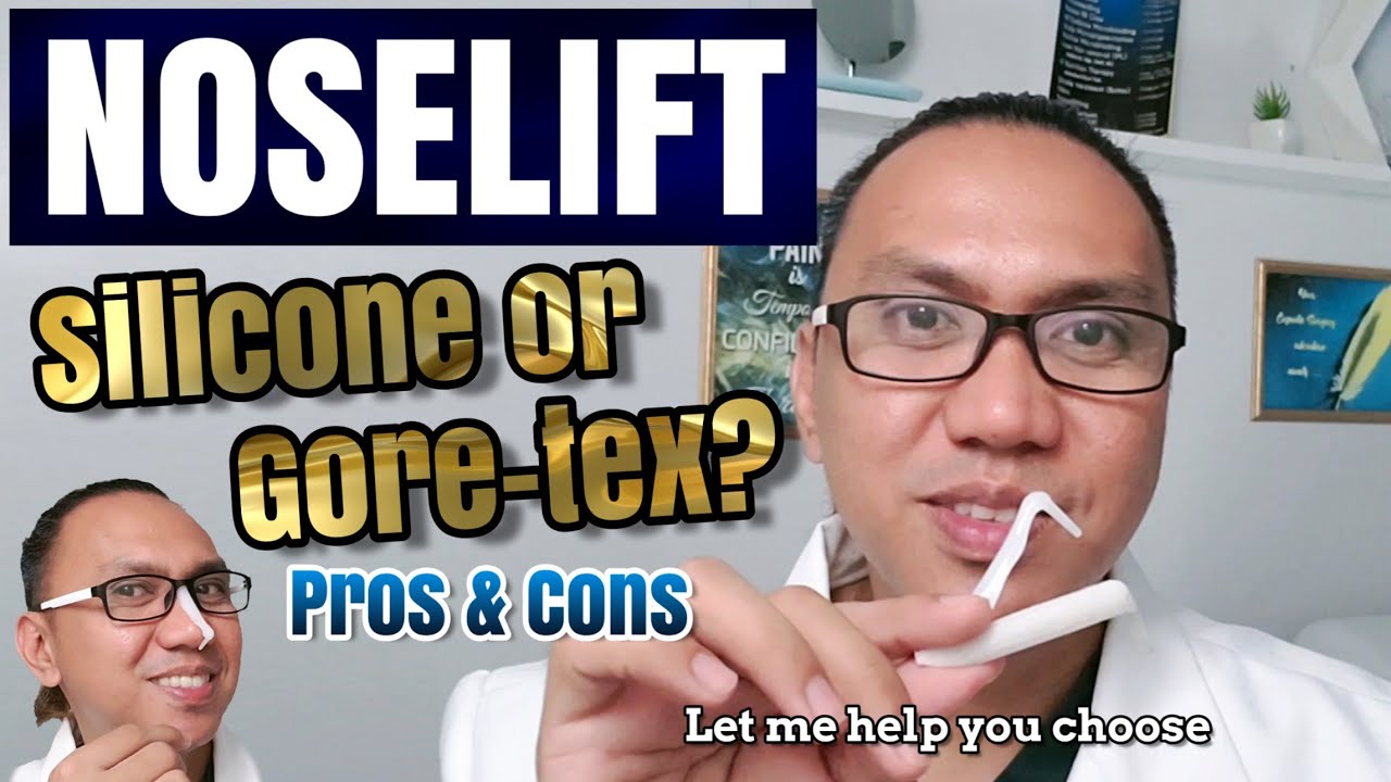 RHINOPLASTY Nosejob Pros & Cons of Silicone and Gore-tex Nose Implants ...